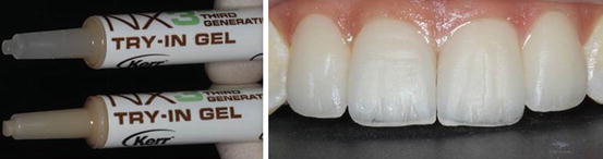 Facial Dentofacial Analysis Pocket Dentistry