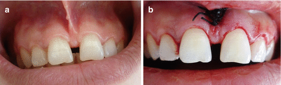 Facial Dentofacial Analysis Pocket Dentistry