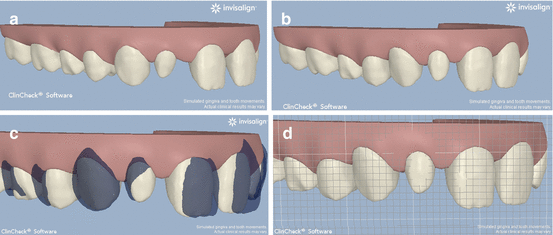 Facial Dentofacial Analysis Pocket Dentistry