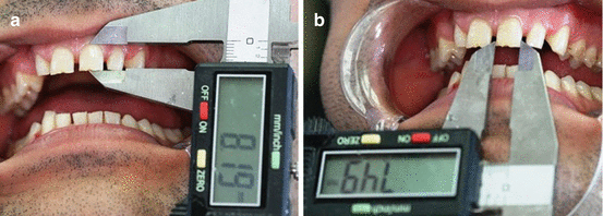 Facial Dentofacial Analysis Pocket Dentistry