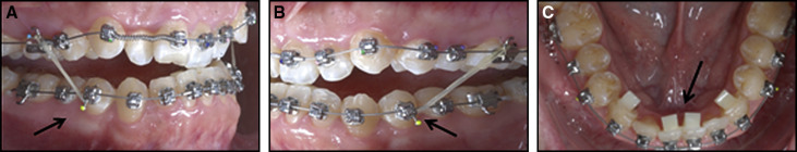 gr7.jpg | Pocket Dentistry