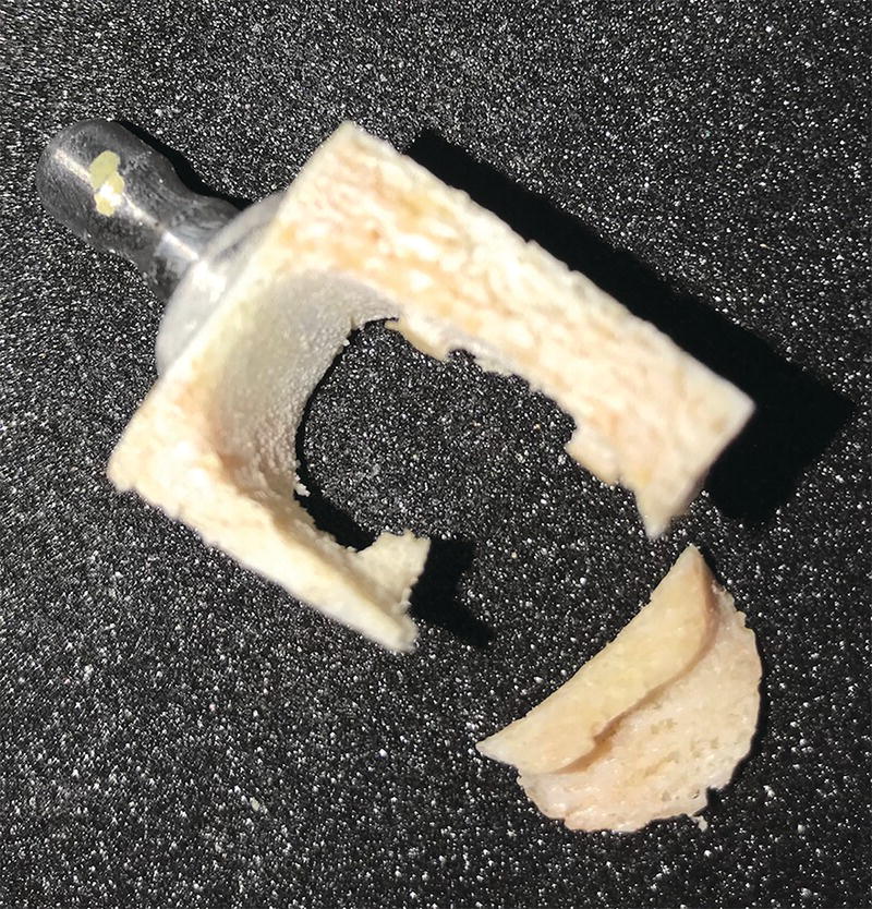 Digital Workflow In Implant Dentistry Pocket Dentistry