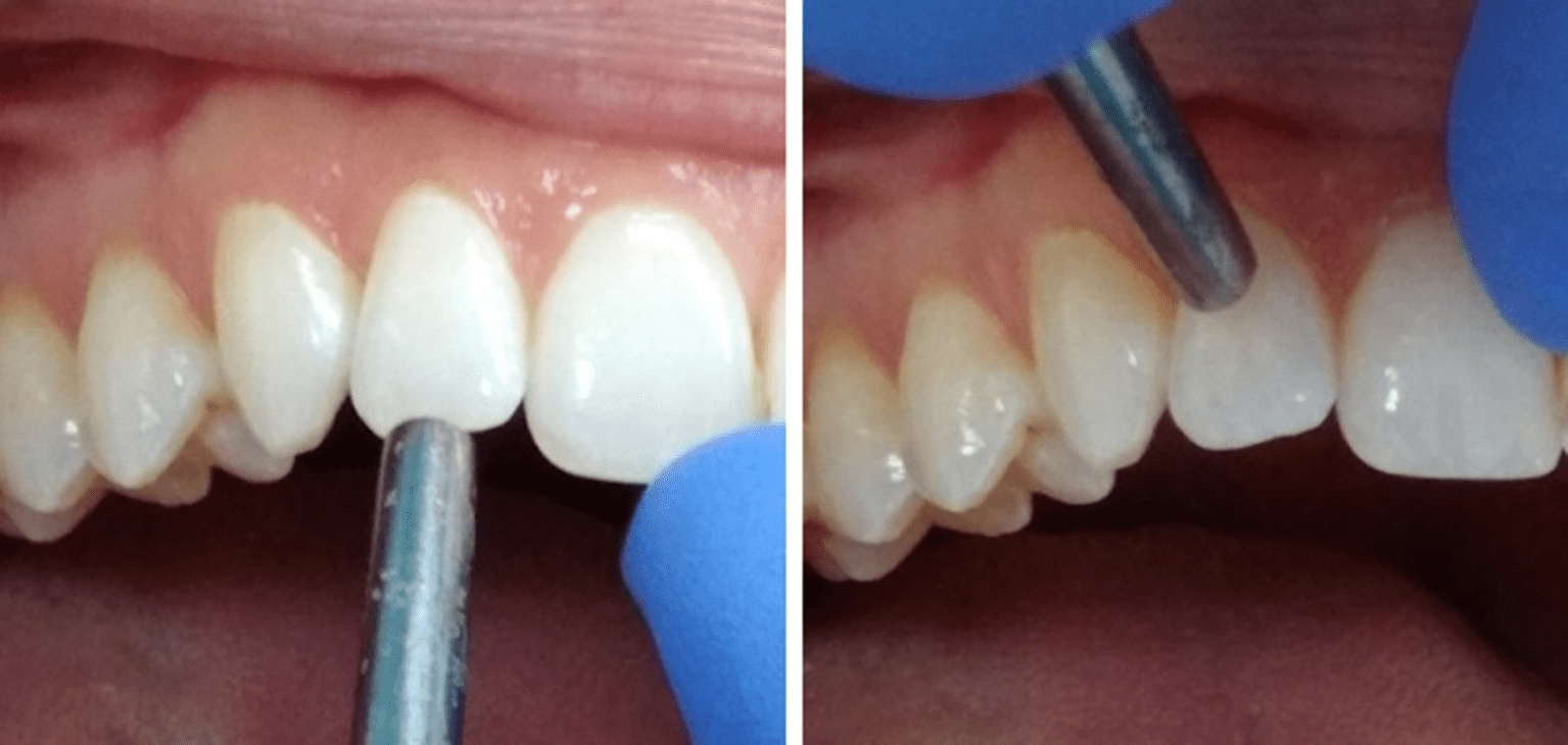 Endodontic Diagnosis Pocket Dentistry